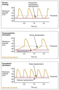 Depolarization in Sinus Rhythm