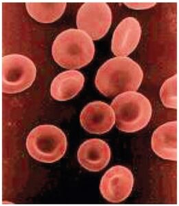 Shape of Red Blood Cells